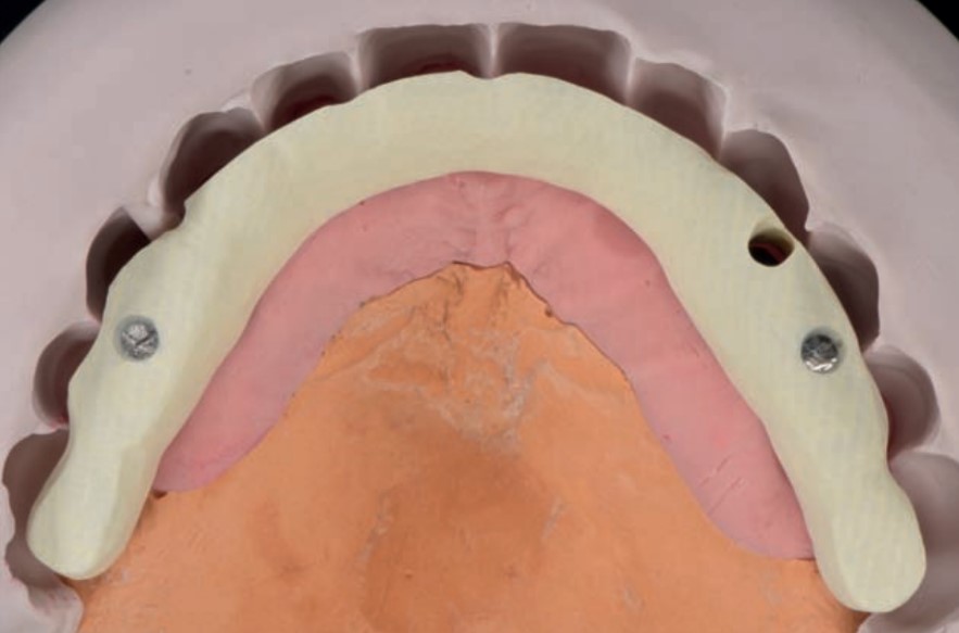 TRILOR® Arch - Bioloren Italian Website